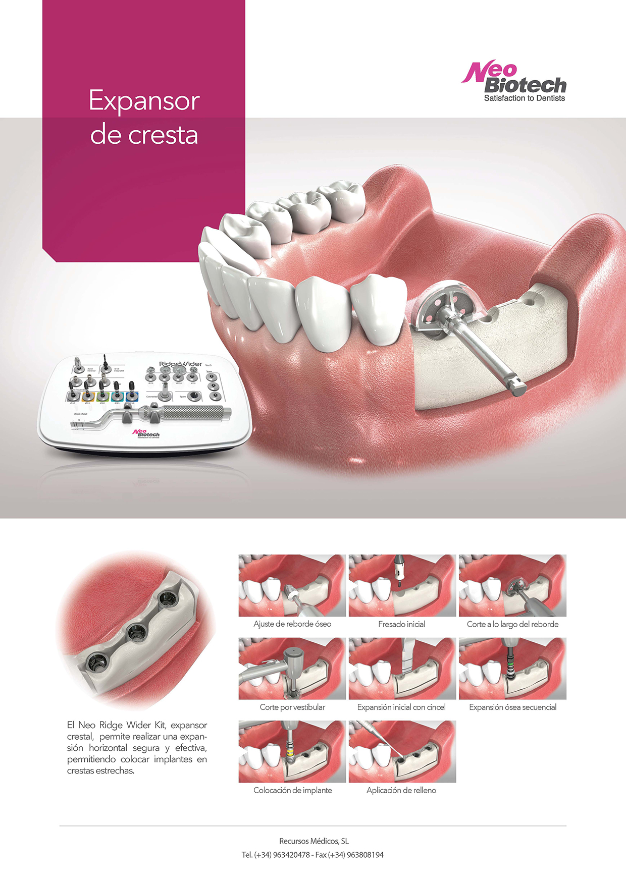 ⭐ Ridge Wider Kit, expansor de cresta alveolar - Recursos Médicos