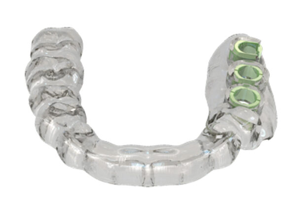 ⭐ Neo NaviGuide Narrow, cirugía guiada - Recursos Médicos