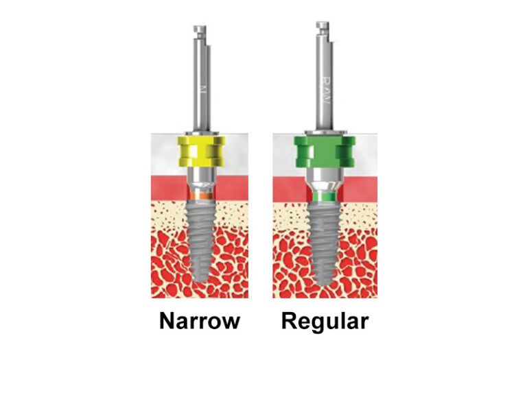 ⭐ Neo NaviGuide, cirugía guiada - Recursos Médicos
