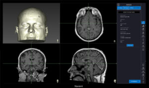 Navident 4 EVO Next Generation Dynamic Navigation - Recursos Médicos