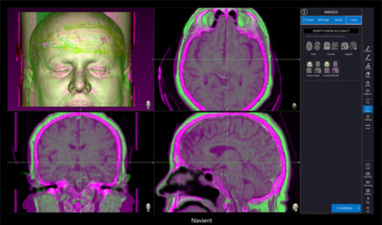 Navident 4 EVO Next Generation Dynamic Navigation - Recursos Médicos