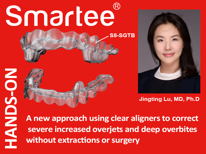 ⭐ Hands-on Alineadores Smartee S8. Dr Lu. 9 Febrero 2023. - Recursos ...